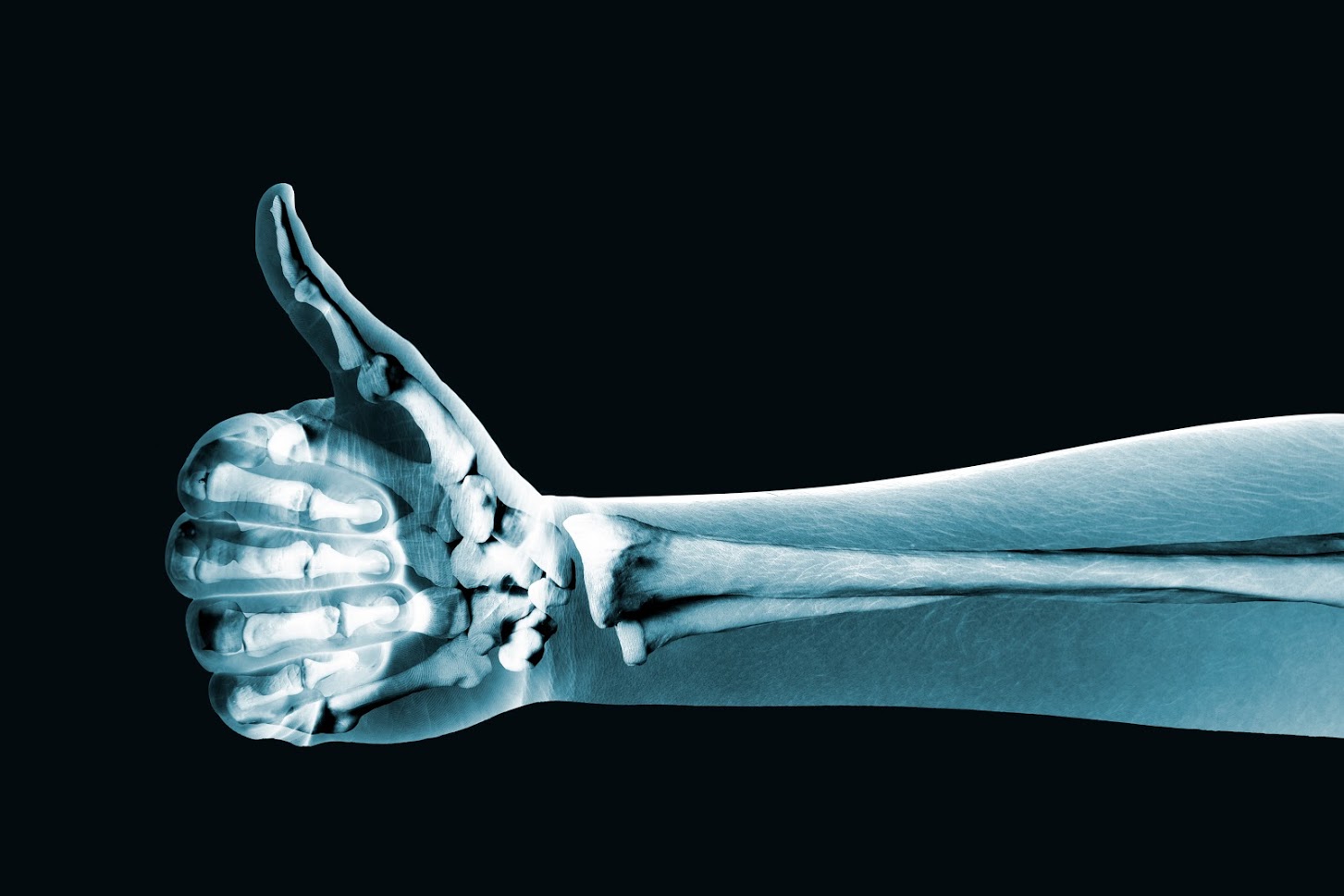 Simple Ways To Protect Your Bones Simple Ways To Protect Your Bones